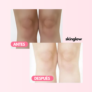 Crema Aclarante Skinglow